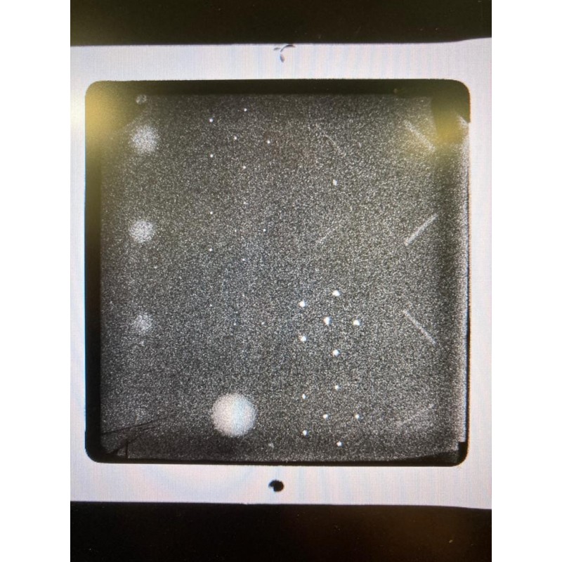 GE Senographe Essential Mammography